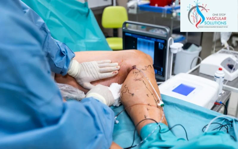 One Stop Vascular Solutions