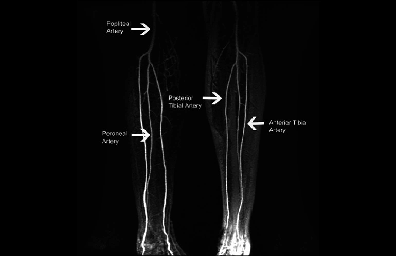 Best Angiography Treatment hospital in Hyderabad